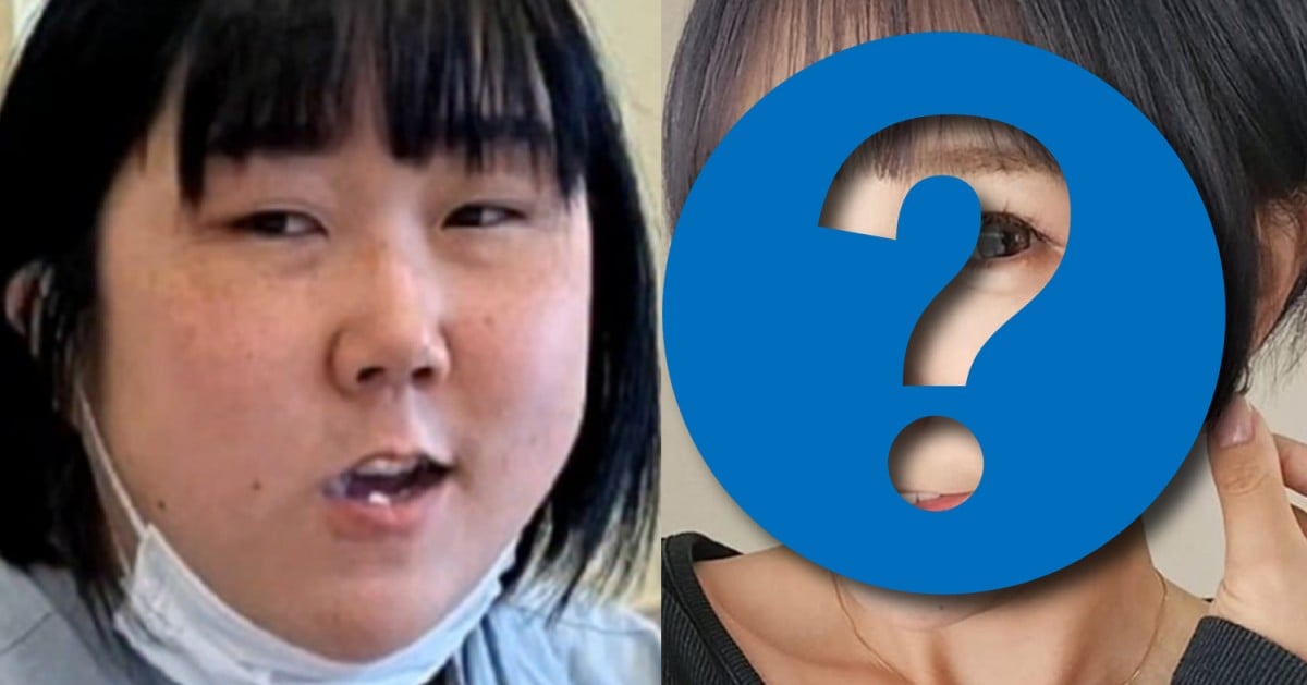 「O型（大型）でしょ？」周囲の“イジリ”に傷ついた…100キロ超えから約40キロ減量成功で別人級「キラキラして見えます」｜eltha（エルザ）